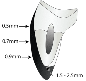Porcelain Veneer Prepping 101 - Burbank Dental Lab