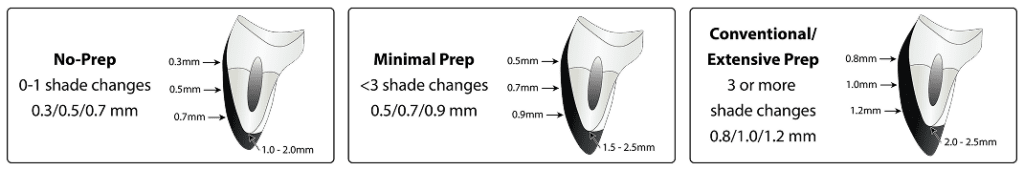 Porcelain Veneer Prepping 101 - Burbank Dental Lab