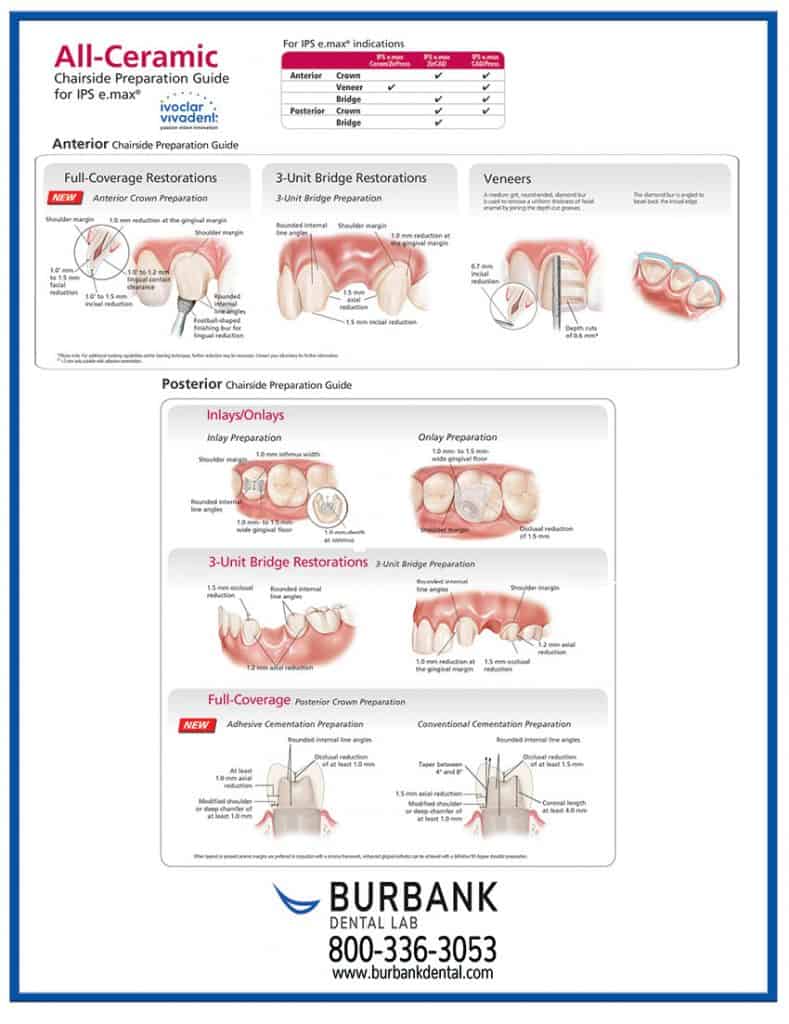 IPS E.max All-Ceramic Prep Guide - Burbank Dental Lab