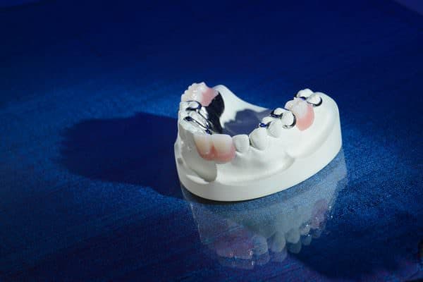 Dentures - heat-cured Lucitone® 199 - Burbank Dental Lab