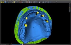 Thank You - Burbank Dental Lab
