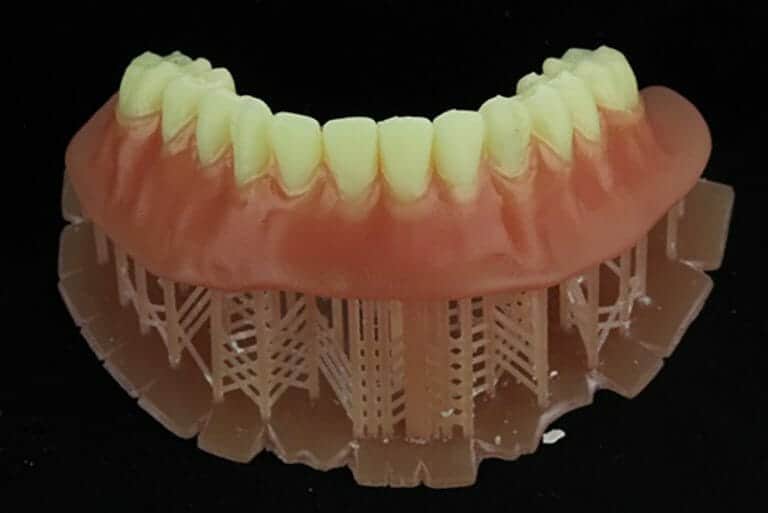 Denture Conversion And Digitally Guided Implant Surgery