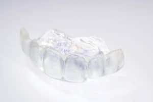 Occlusal Guards And Splints - Burbank Dental Lab