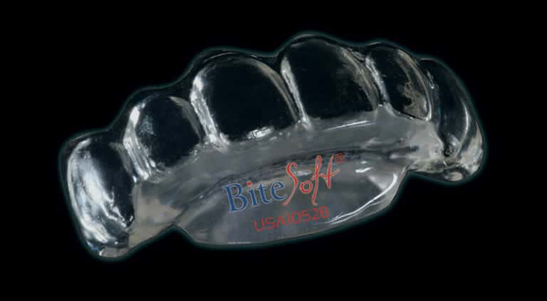Occlusal Guards And Splints - Burbank Dental Lab