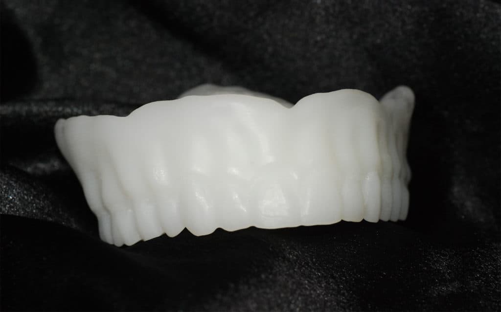 A Digital Denture Workflow Done In 3 Appointments - Burbank Dental Lab