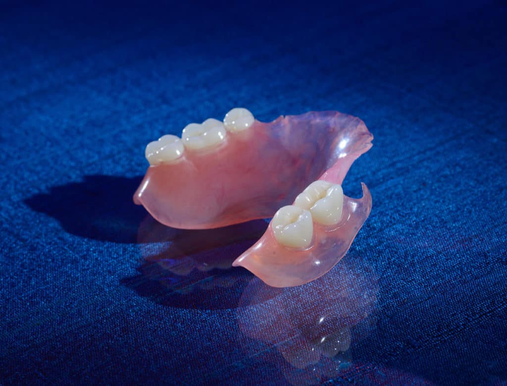 Valplast Flexible Partials: Planning For Case Success - Burbank Dental Lab