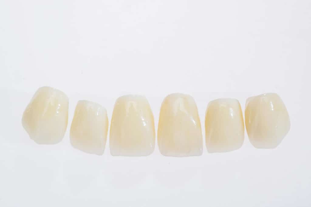 IPS E.max: Strength In A Smile - Burbank Dental Lab