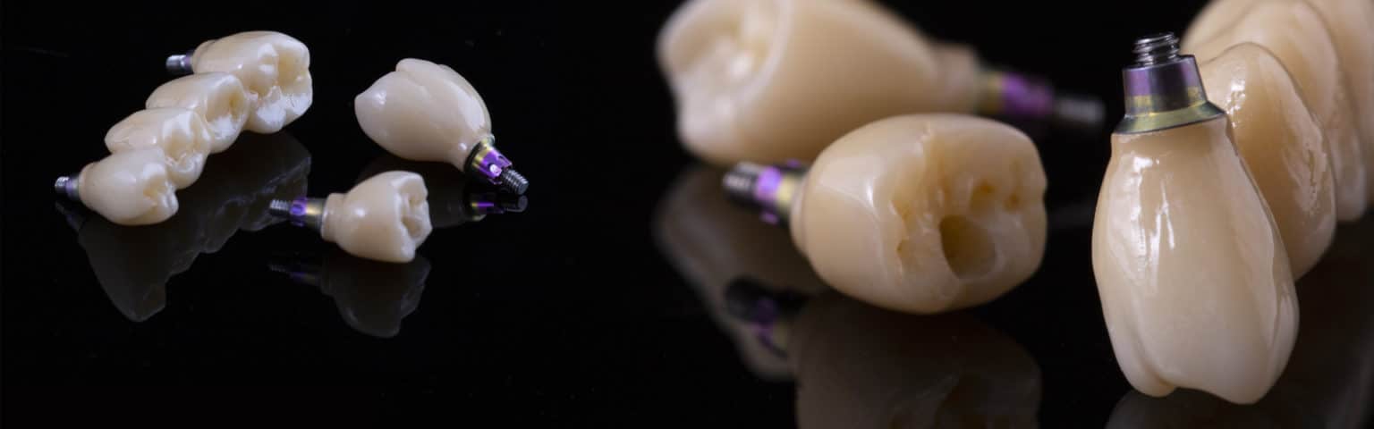 TAP 3 Device For Treatment Of Sleep Apnea - Burbank Dental Lab