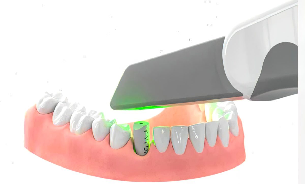 DuraTemp: It's All In The Planning - Burbank Dental Lab