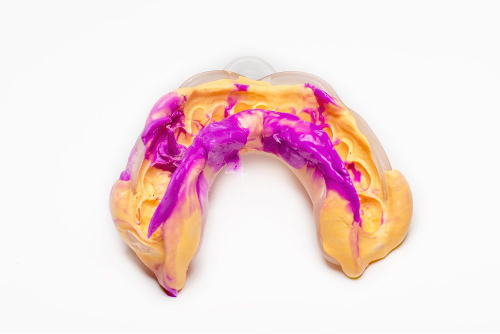 DuraTemp: It's All In The Planning - Burbank Dental Lab