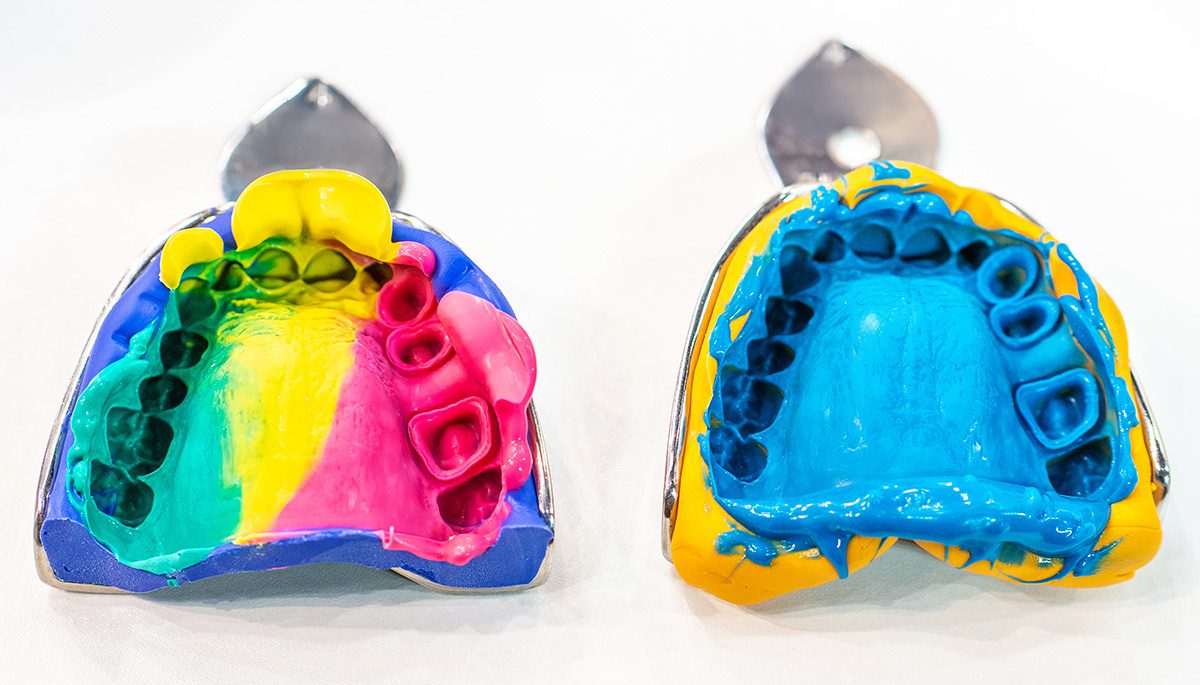 DuraTemp: It's All In The Planning - Burbank Dental Lab