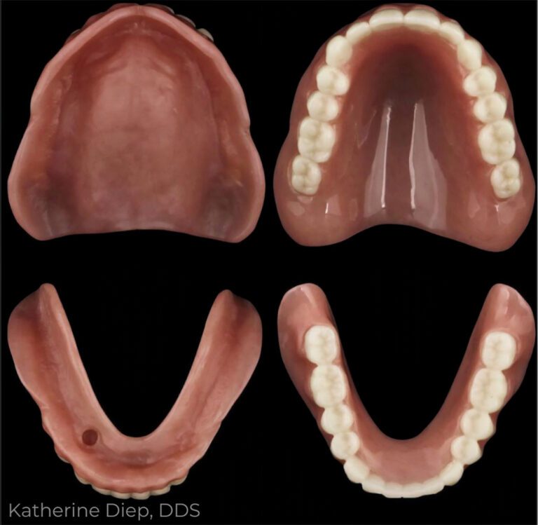 Benefits Of Digital Denture Workflows - Burbank Dental Lab