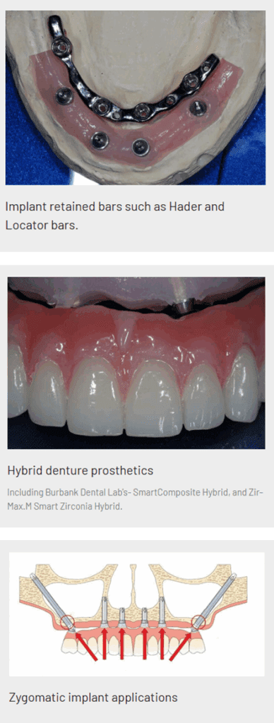 Multi-Unit Abutments: When And How To Use Them