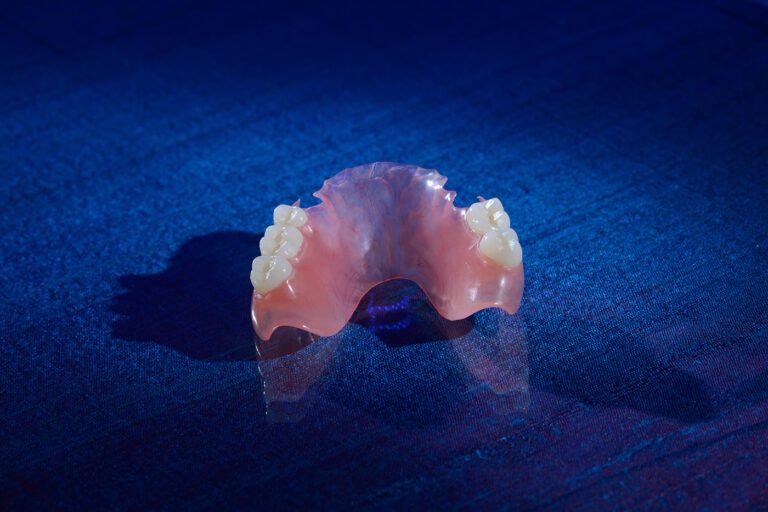 Valplast Partial Denture - Burbank Dental Lab