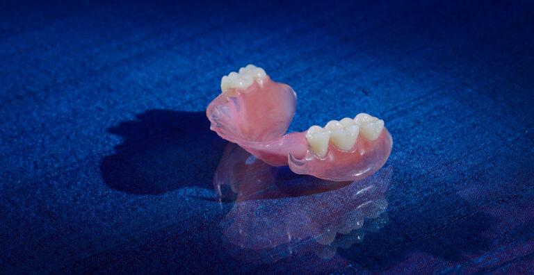 Valplast Partial Denture - Burbank Dental Lab